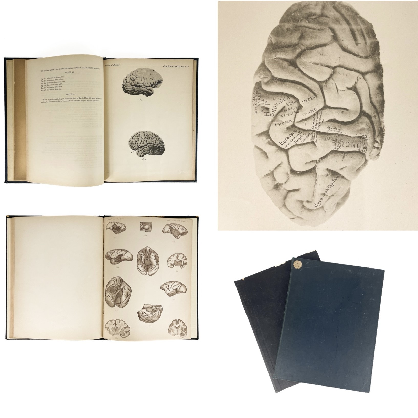 Lot 301 - The Cerebral Cortex and the Motor Cortex.
